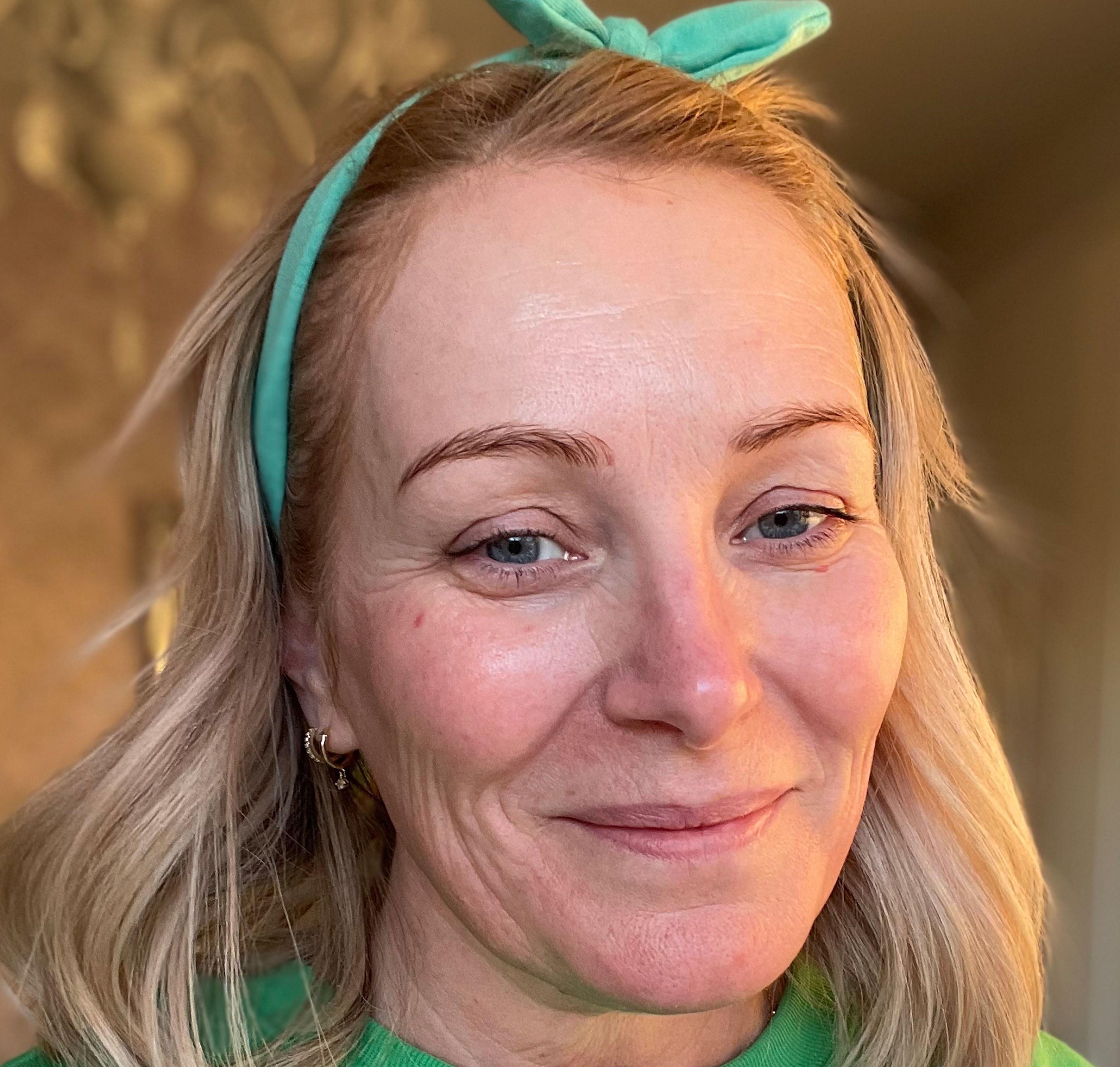 Sam's Skincare Story | Nip + Fab